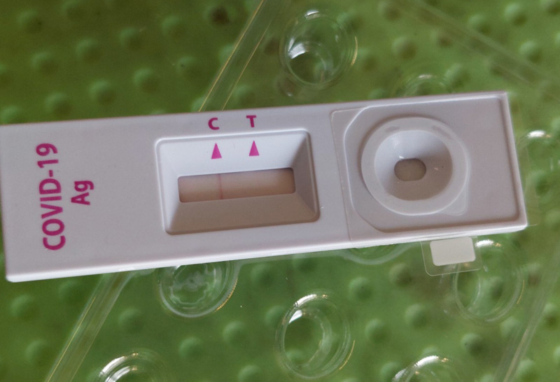 สธ. ย้ำหากผลตรวจ ATK เป็นบวก ไม่ต้อง RT PCR ซ้ำ ได้